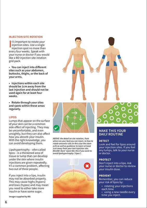 BD, Becton Dickinson, injection kit, injection technique, injecting ...